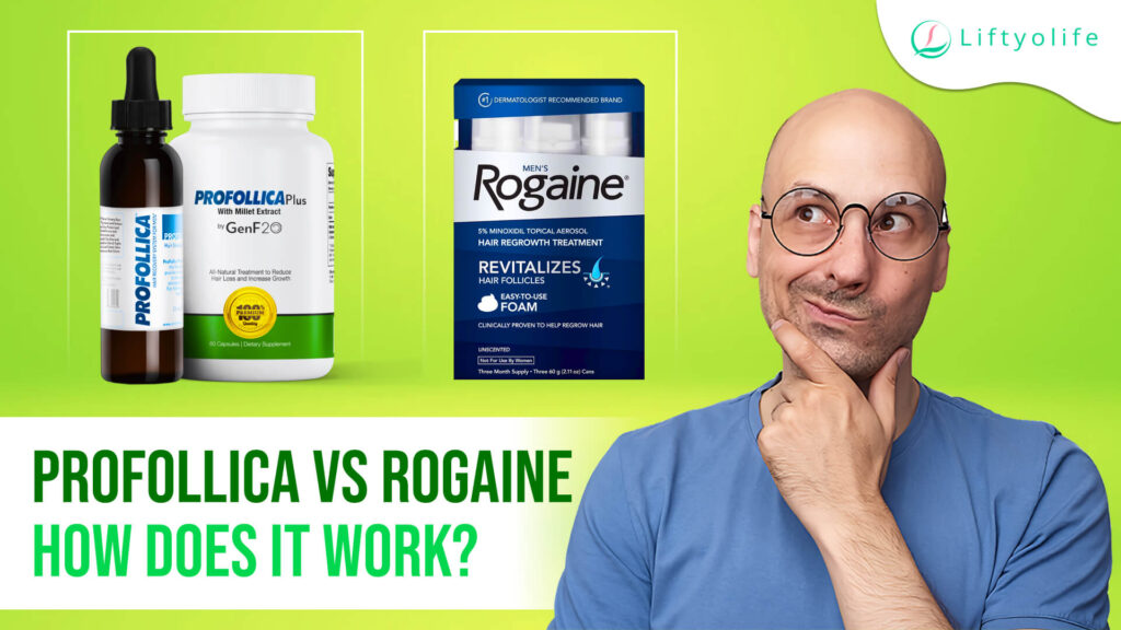 Profollica Vs Rogaine: Which Is The Right One For You? | Liftyolife